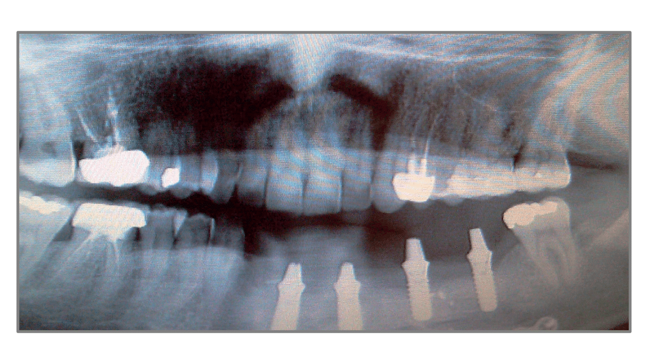 DIU Carcinologie buccale 2025-2026 - Unicancer